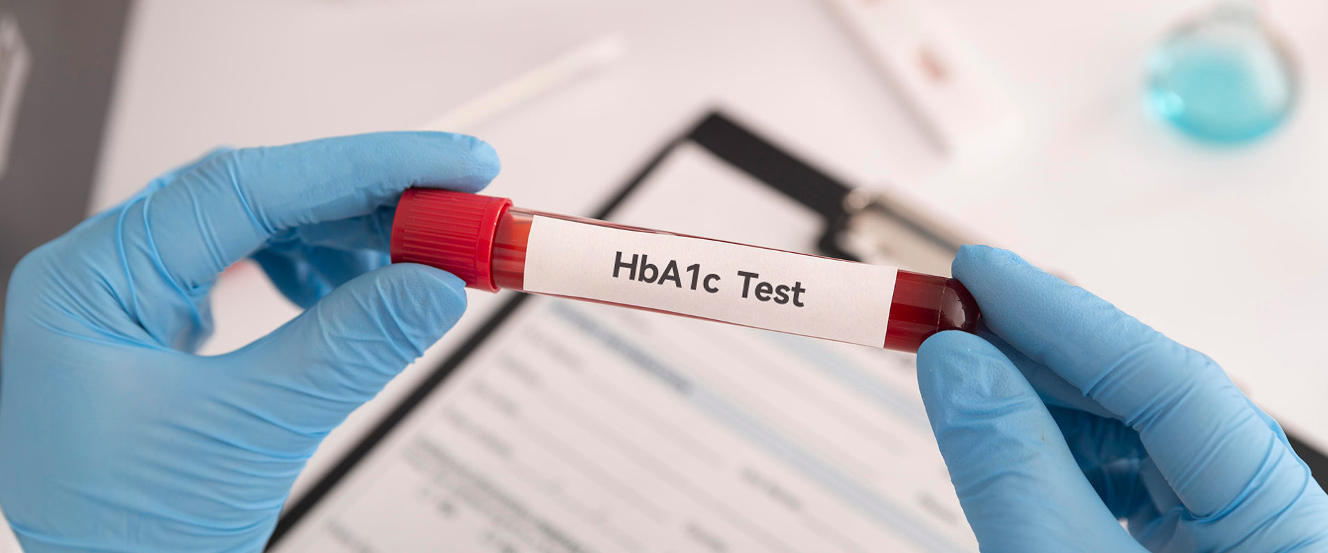 What is HbA1c? Understanding the Average Blood Sugar Test – LinX Vista